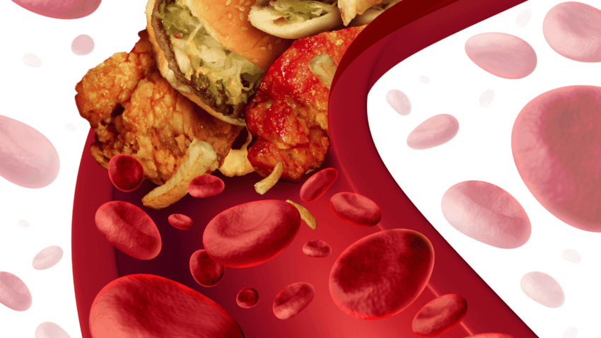 Understanding Normal Cholesterol Levels: Importance, Ranges, and Heart ...